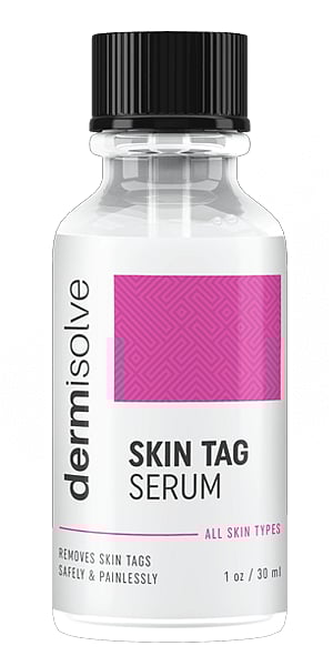 Cryogen Skin Tag Remover [Controversial UPDATED 2023] - Defy Skin Tag ...