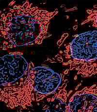 'Cell wars' that could boost cancer treatments