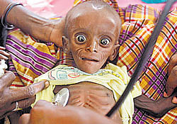 Somali 7-month-old weighs the same as newborn