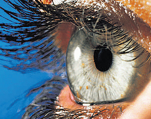 Implantable eye devices that improve vision