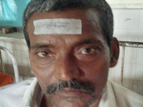 Probe into pasting of 'bhukamp' sticker on injured