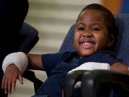 World's first double hand transplant on child carried in US