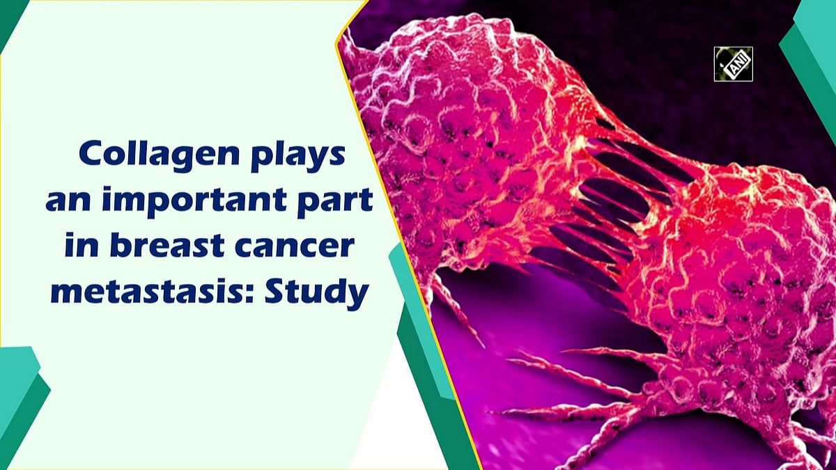 Collagen plays an important part in breast cancer metastasis: Study