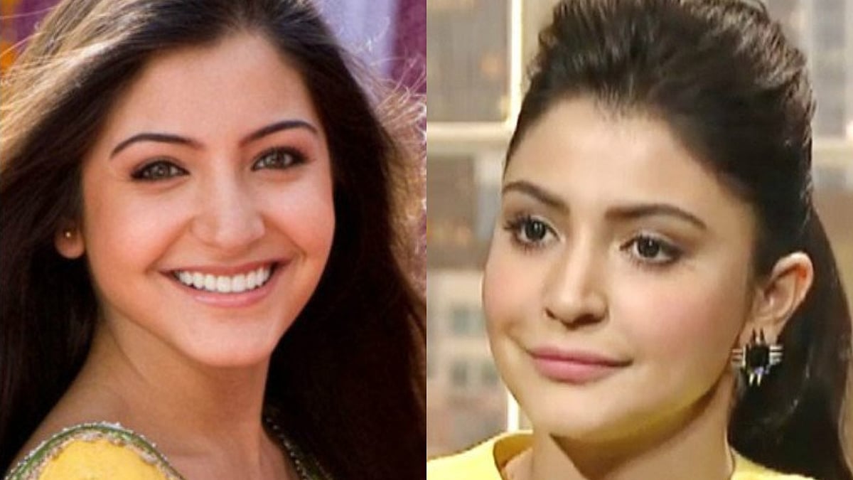 In Pics | Stars with cosmetic surgeries gone wrong