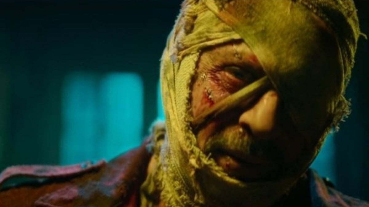 SRK's first look with bandaged face from 'Jawan' goes viral